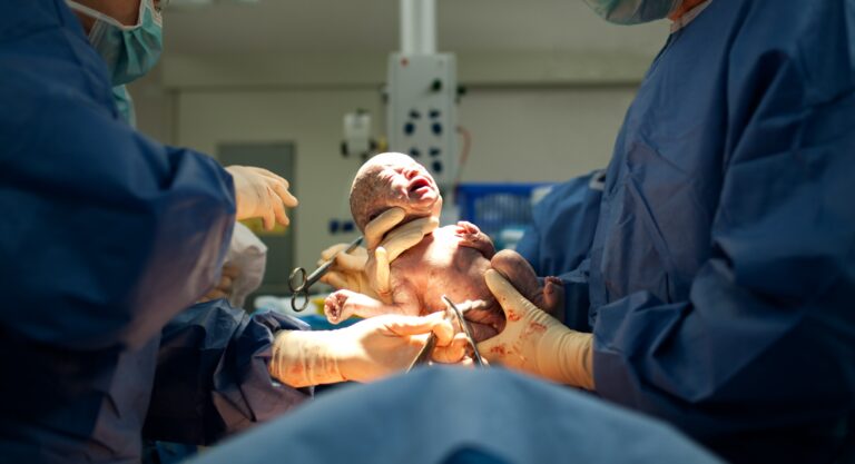 Normal Delivery - Preparation for a Natural Birth